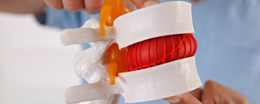 Understanding Spinal Decompression Therapy: A Non-Surgical Solution for ...